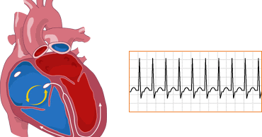 Pansystolic Murmur Symptoms, Causes, Sound, Treatment - Health Care ...