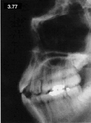 Radiología Oral y MaxiloFacial