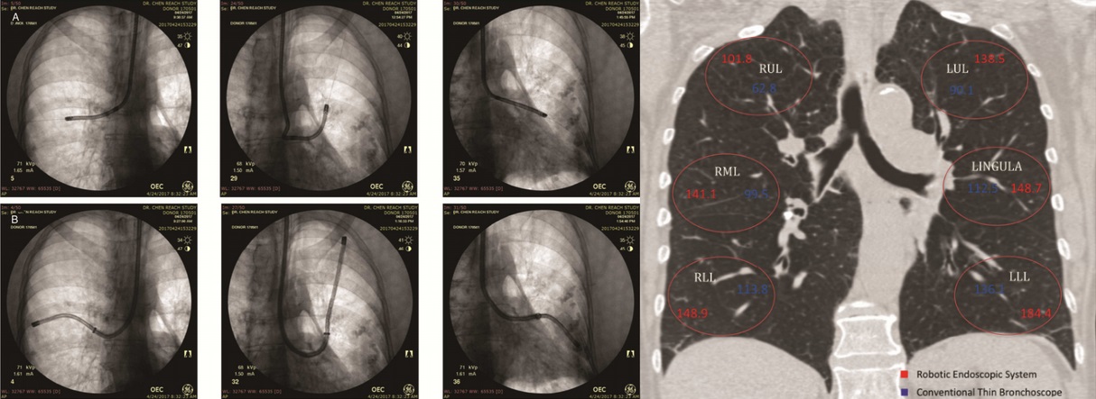 Updates on Auris' early clinical use