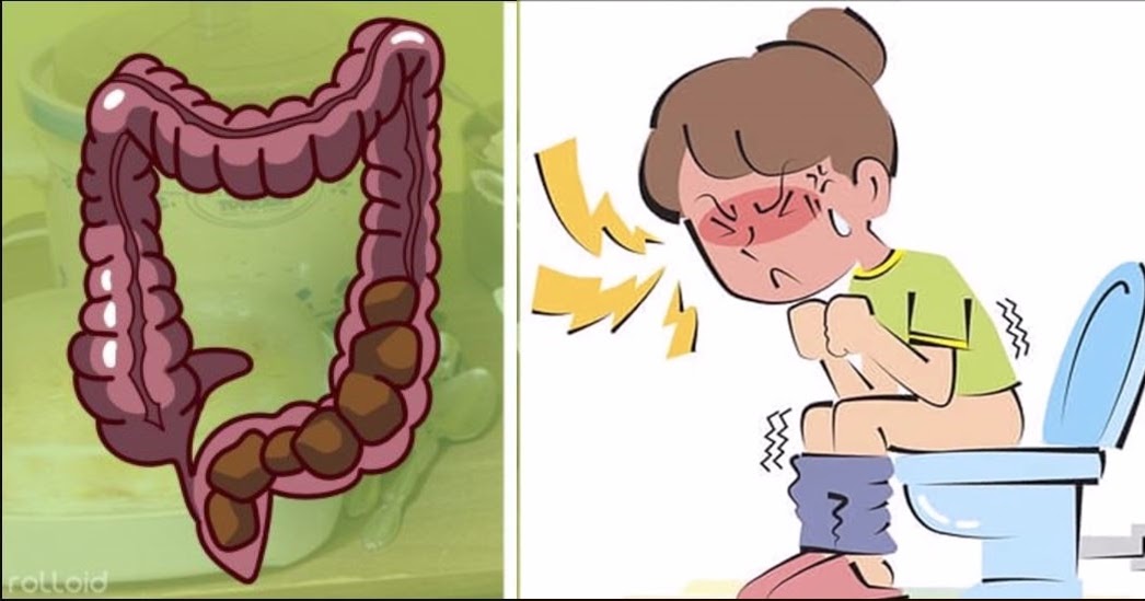 La llaman la saca caca porque en 24 hora deja el colon vacío sin rastro ...