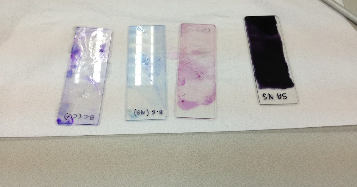 Experiment 6: Preparation of bacterial smear, Experiment 7: Simple ...