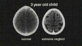 Nikkis Blog: Feral child Genie Wiley