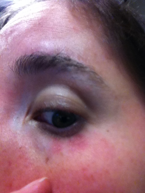 Just Another Day in Wileydise: Face Rot