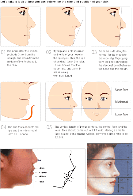 ID Hospital Korea: Small Chin Correction