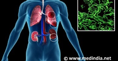 O cauză rara de hemoptizie