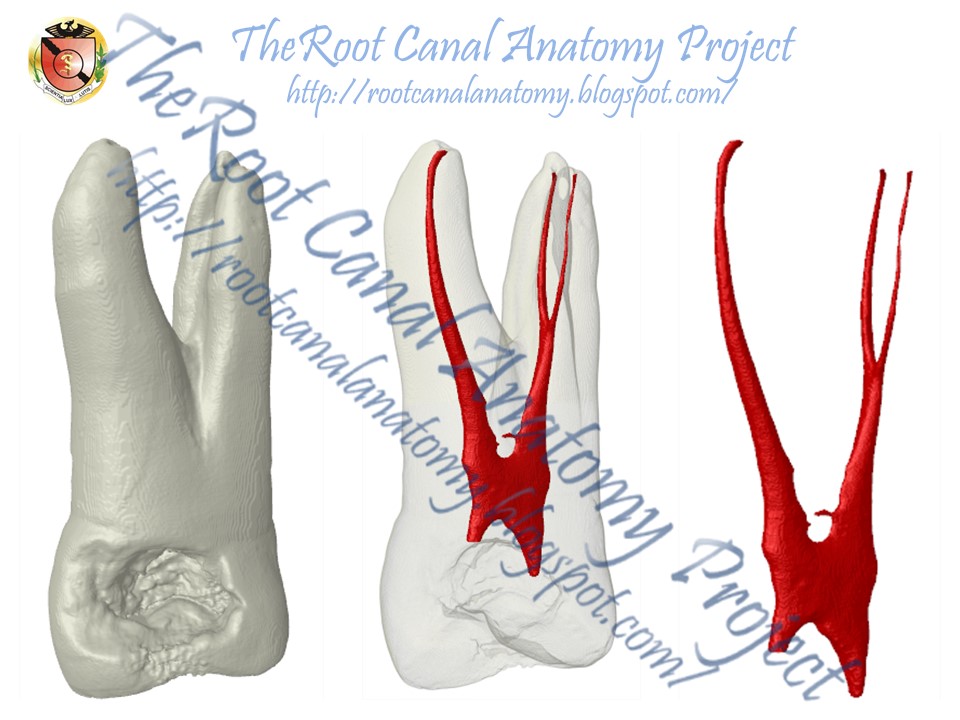 The Root Canal Anatomy Project: October 2015