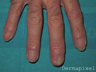 Dermapixel: abril 2013