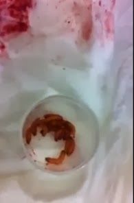 FAST INFO MAGAZINE: The true story behind the lady with vagina full of ...