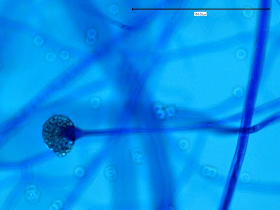 Fun With Microbiology (What's Buggin' You?): Absidia corymbifera ...