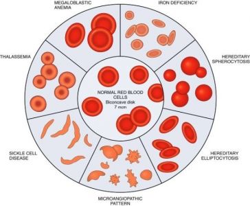 ANEMIA MENURUT MORFOLOGI ~ M. Azhari Rangkuti