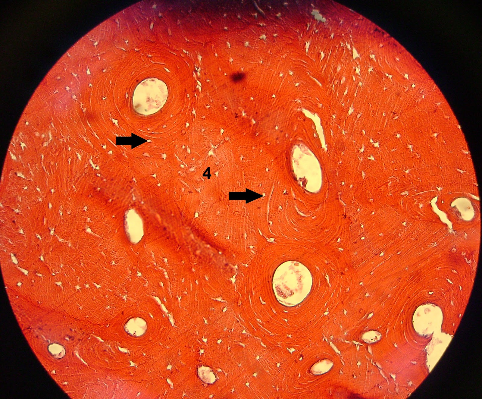 Histologia UFJF: Tecido Ósseo - Osso Compacto