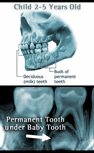 Szmanda Dental Blog: BABY TEETH