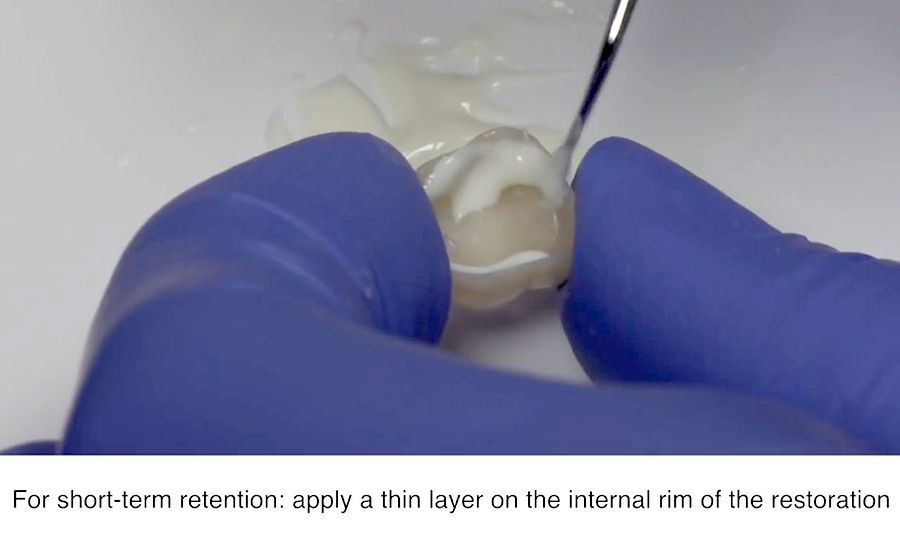 DENTAL MATERIALS: Fuji TEMP LT™ - GC Europe