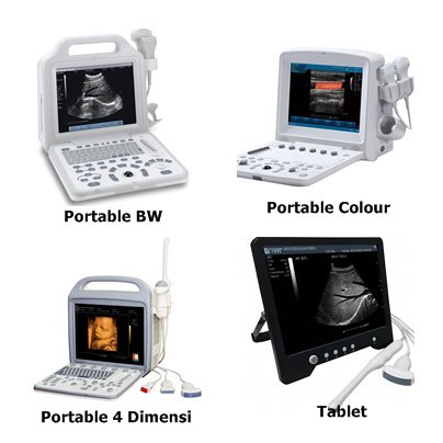 BILIK SONOGRAFER : Jenis Jenis Mesin Ultrasonografi (USG)
