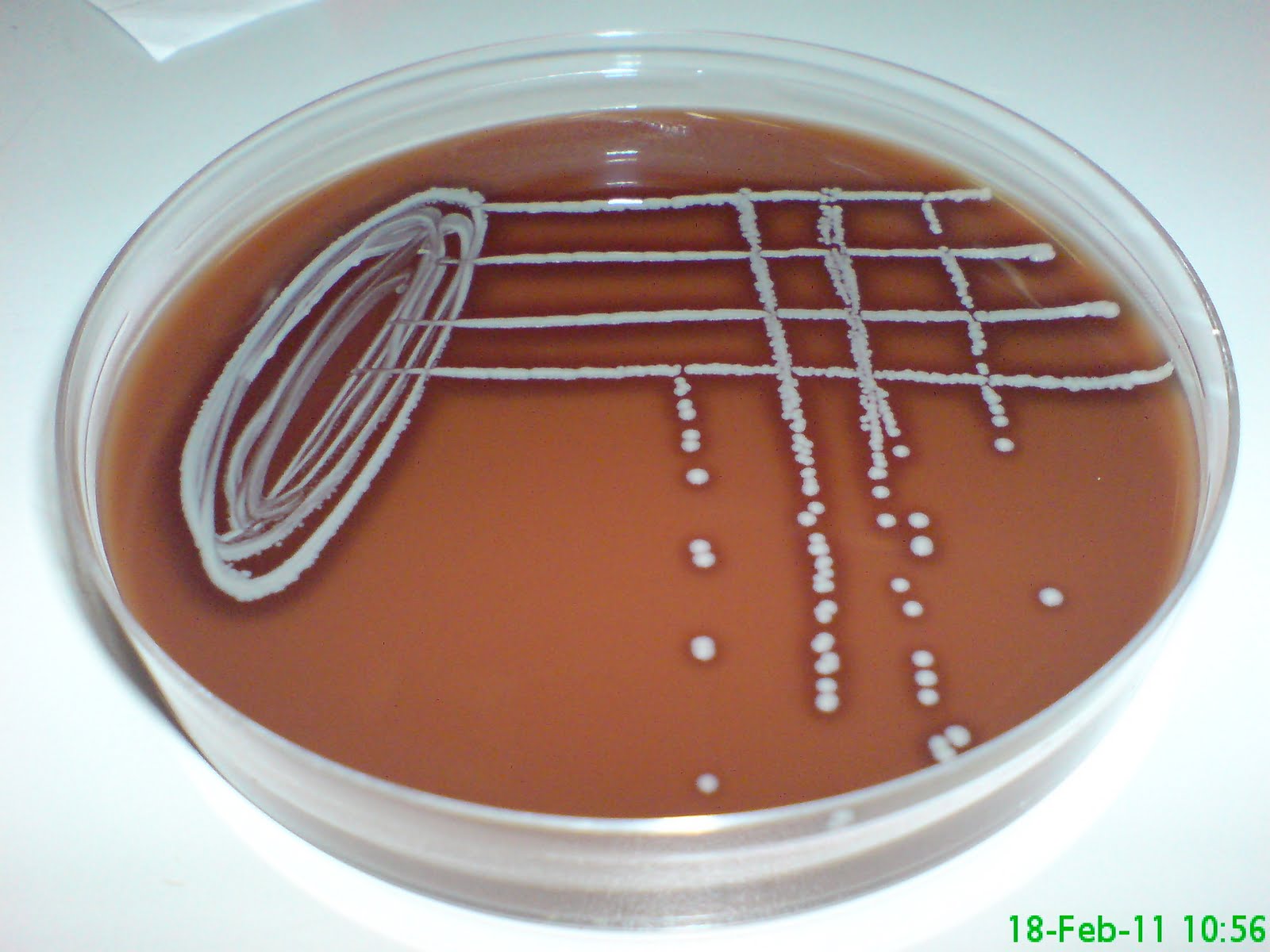 Pengembara tanpa kompas.: microbes.........