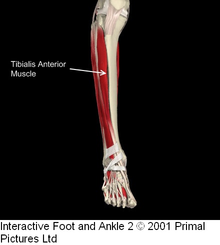 Sportygeia Medicina del Deporte y Fisioterapia.: Periostitis Tibial