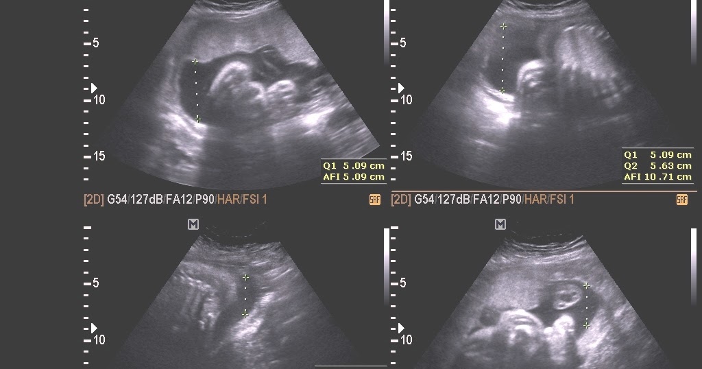 JENIS JENIS USG ~ Perkembangan Teknologi dan Informasi di Bidang Kedokteran