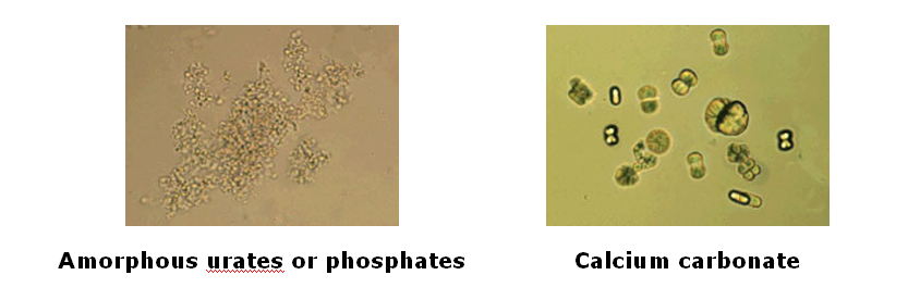 Medical Technologist Study's and Technic's: SPECIAL STUDY'S OF URINE ...