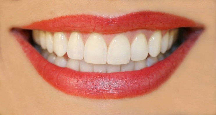 Sherry Brescia's Blog: The key to a great smile