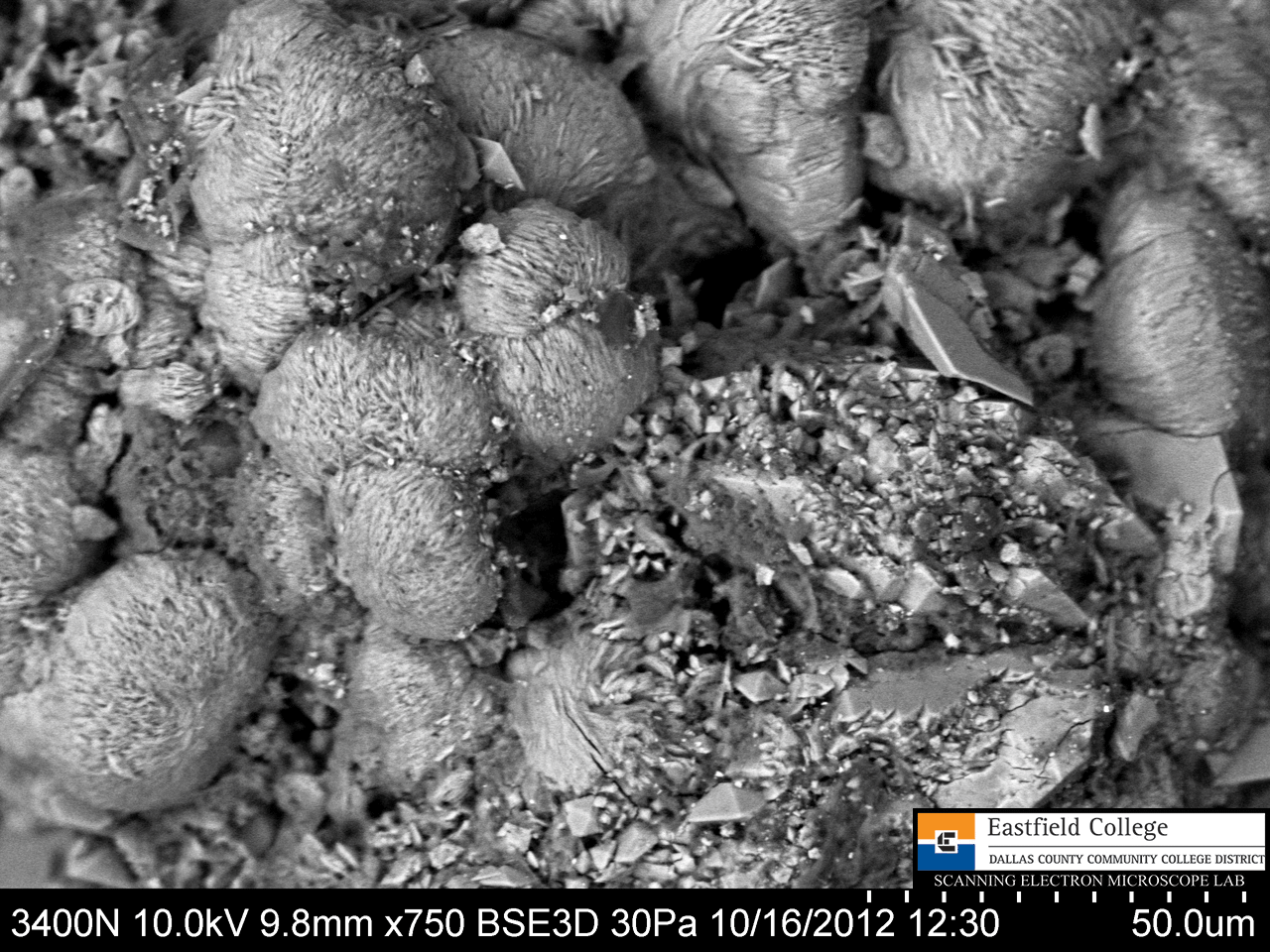 Scanning Electron Microscope Blog: A Kidney Stone - OUCH!!