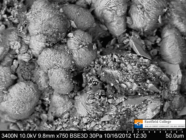 Scanning Electron Microscope Blog: A Kidney Stone - OUCH!!
