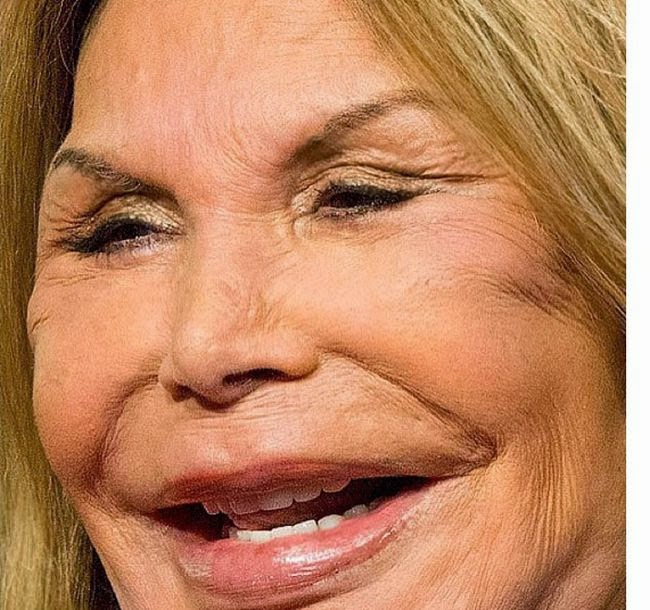 Elsa Patton:The Worst Example Of Plastic Surgery Disaster (28 Pics ...