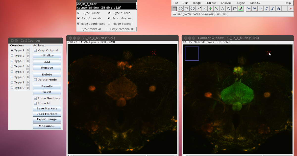 Useful Information: Using ImageJ to count cell bodies in ...