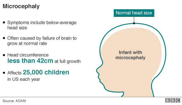 Zika- How it affects infants