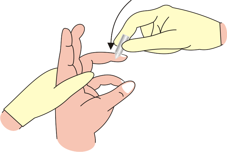 Enseñanza Jurisdicción Texcoco: Paludismo