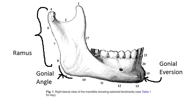 MTI: Missing Tooth Investigators: Male Skull vs Female Skull (Part 3 ...
