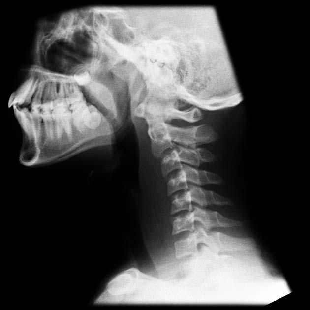 MALAVIKA SHAJI: RADIOLOGY