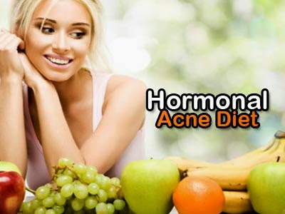 How to Fight Hormonal Acne Through Diet | Hormonal Acne Tips