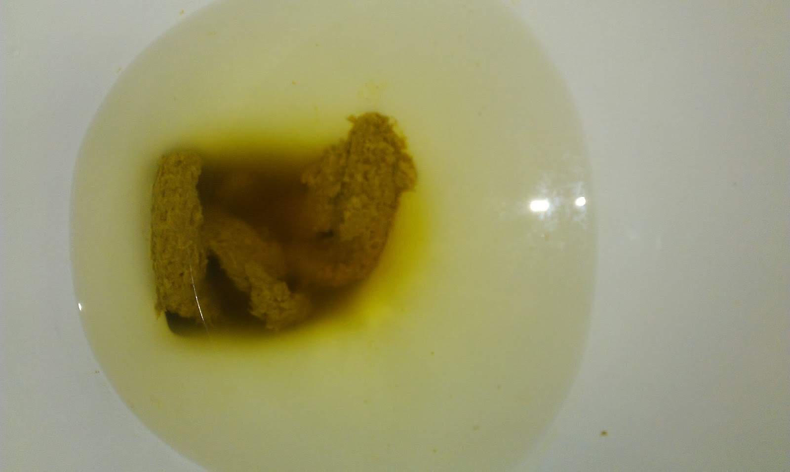 daily poop: radioactive