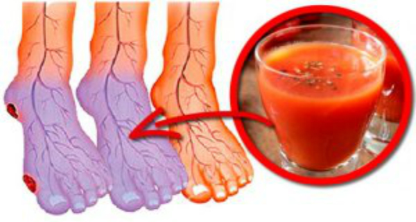 Do You Suffer From Poor Circulation and Your Feet and Hands are Always ...