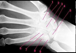 Assalamu Alaikum...: TEKNIK RADIOGRAFI EKSTREMITAS SUPERIOR