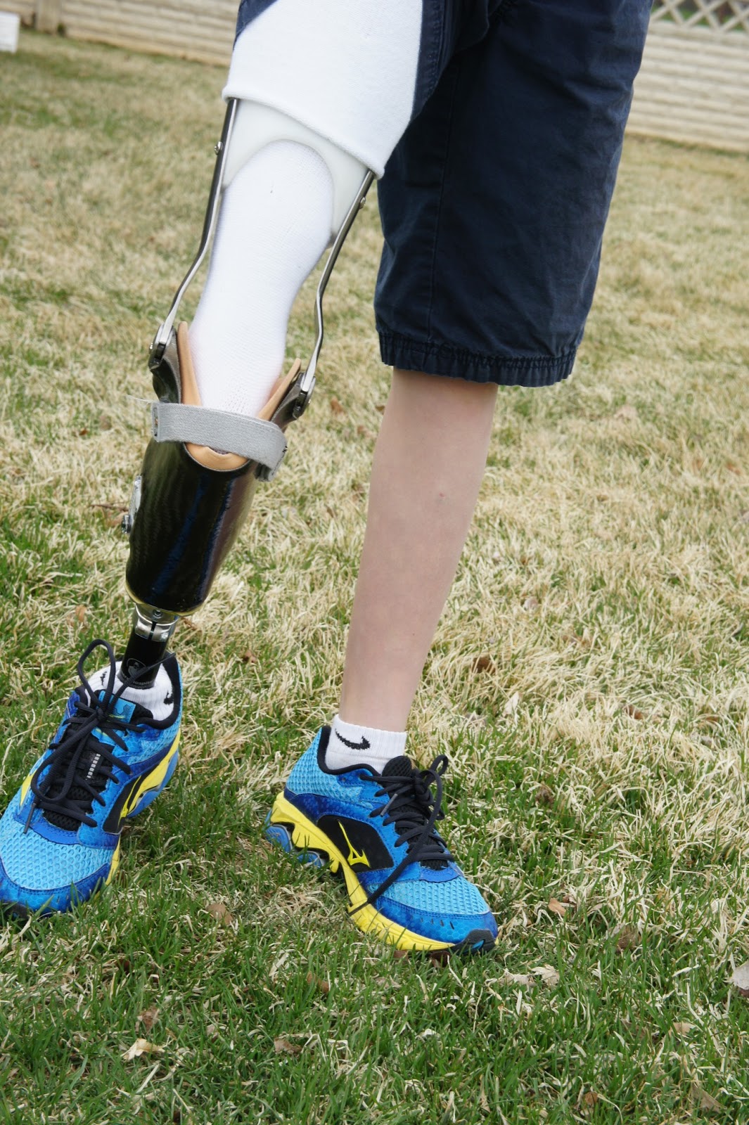 Rotationplasty Prosthesis