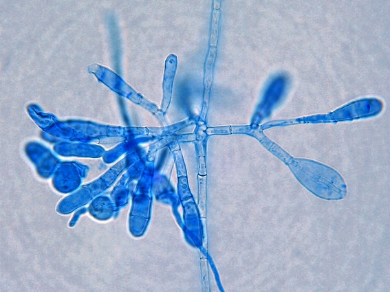 Fun With Microbiology (What's Buggin' You?): Epidermophyton floccosum