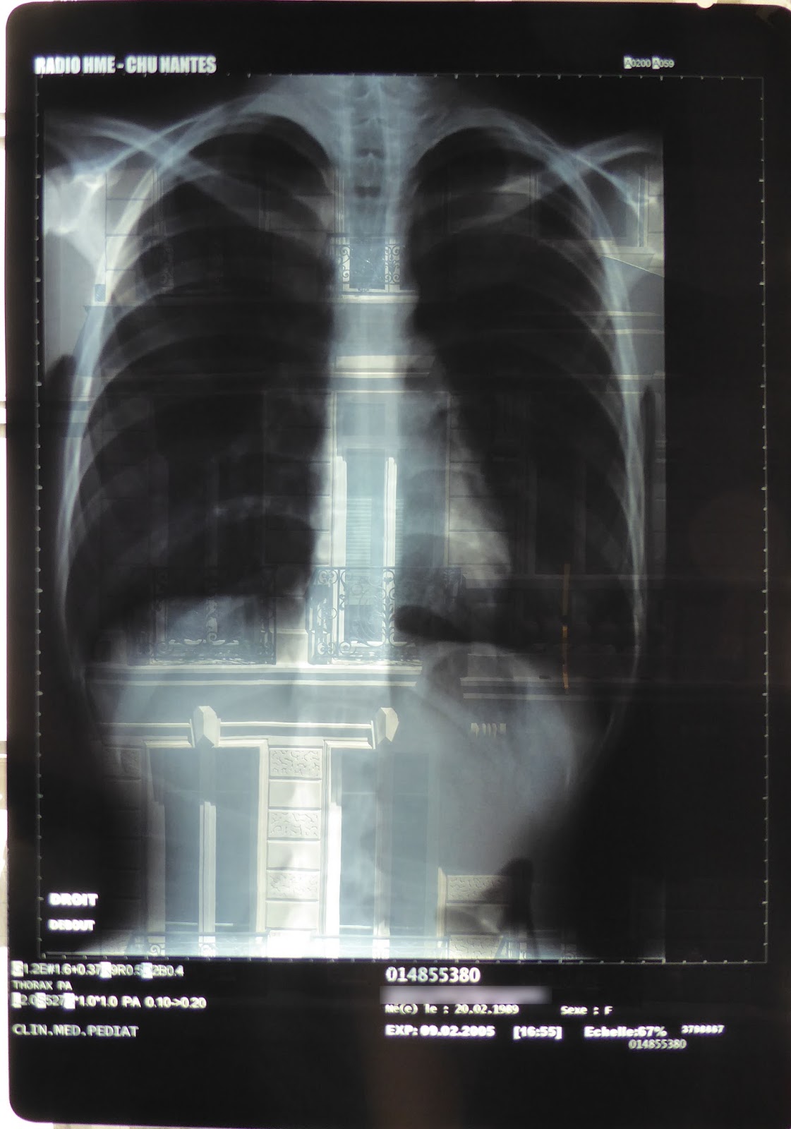 Essen G: Contrôle SNG