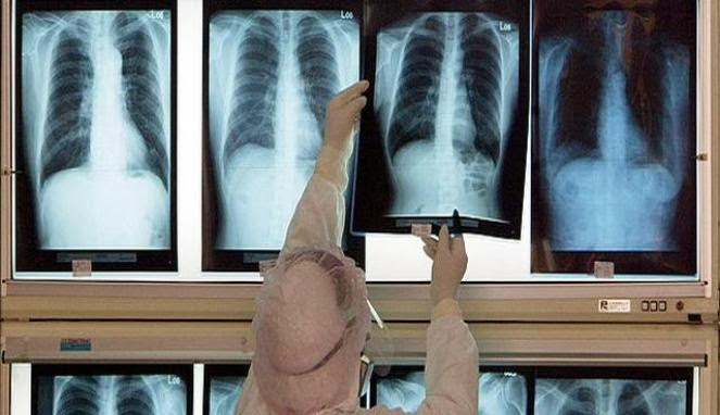 Dunia Radiografer: Sejarah Sinar-X