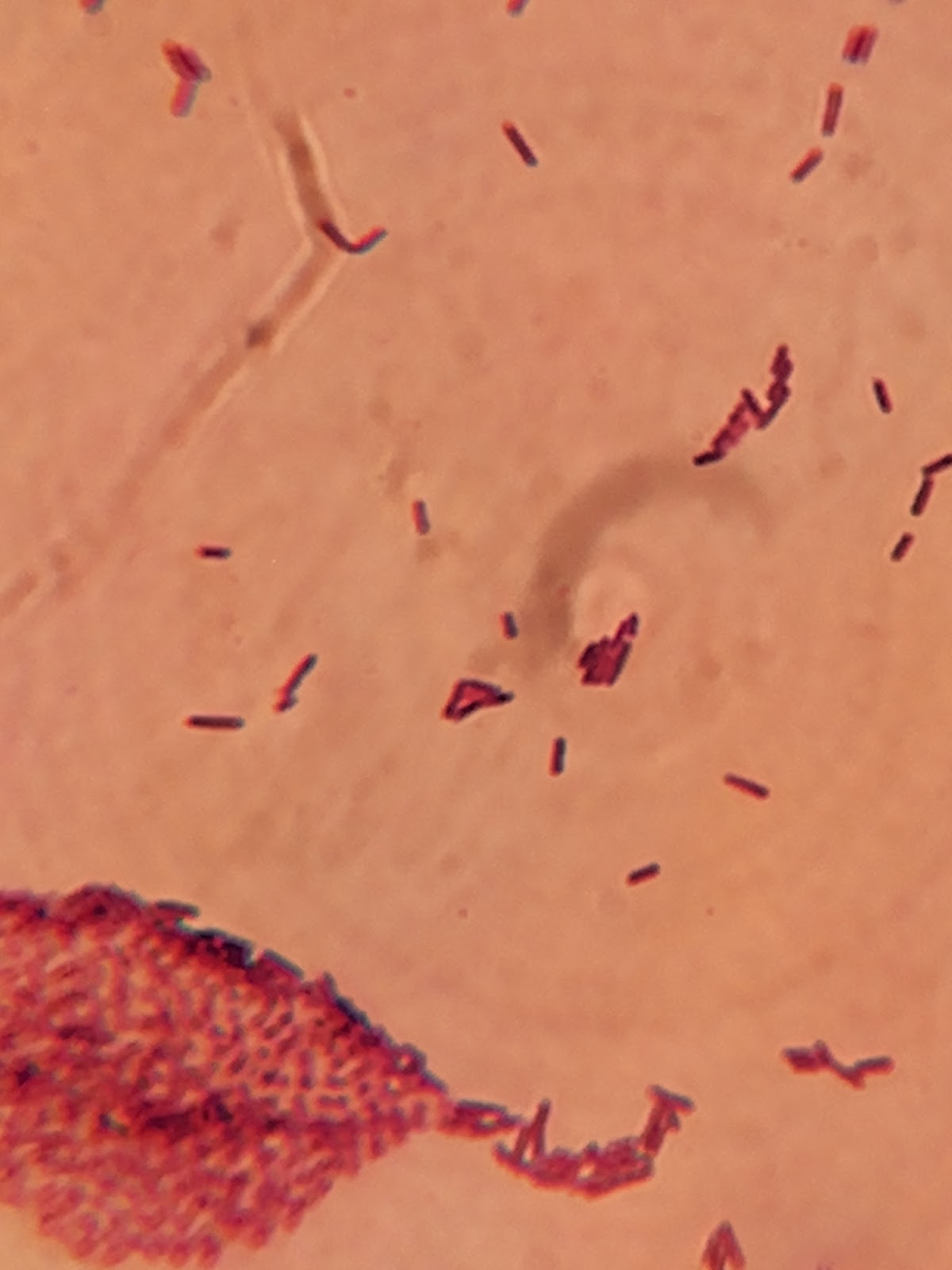 Ram Micro Arena : gram staining and air sampling plate at ngp college ...
