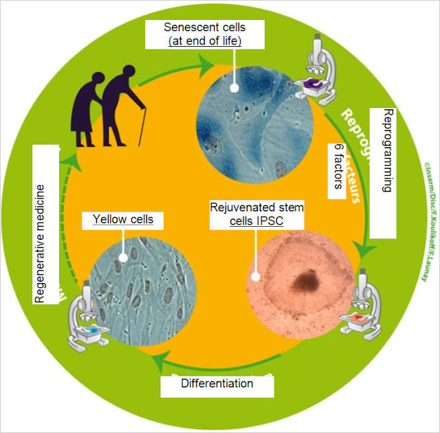 Al Fin Longevity: Rejuvenating 100 Year Old Cells: Advances in ...