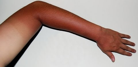 Easy tips, tricks and Ideas: Easy Ways to Remove Sun Tan from Hands