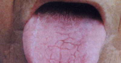 Indicaciones de Semiología Quirúrgica