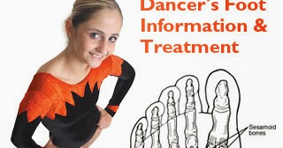 Sports Health: Dancer's Foot Information and Treatment Suggestions
