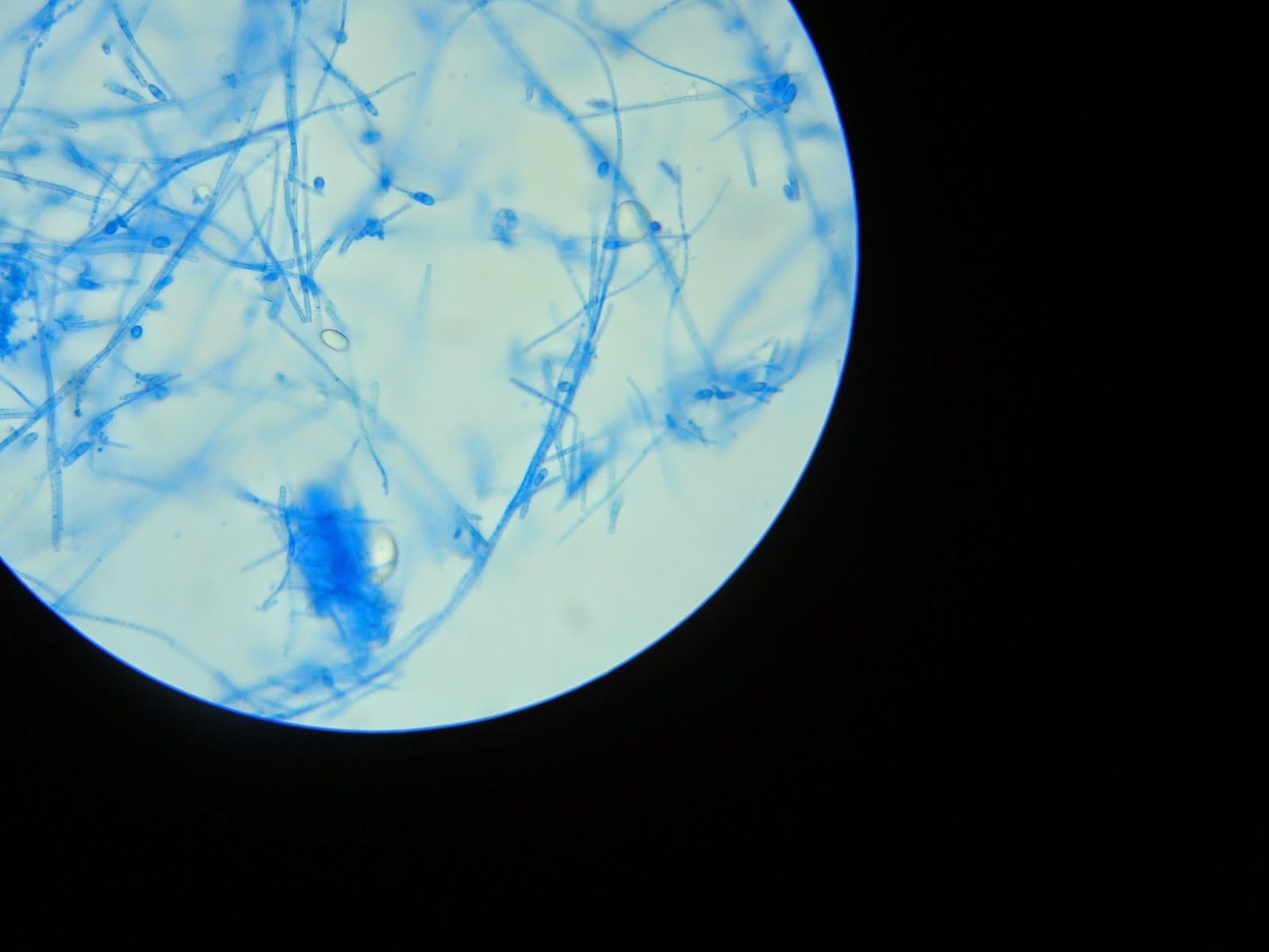 5. miselium vegetatifterdapat dalam substrat untuk menyerap makanan