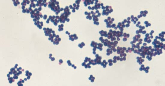Medical Microbiology: Staphylococcus below a cover glass- Makes the ...