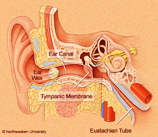 Life of Dora Dori: Telinga tersumbat (earwax clog)