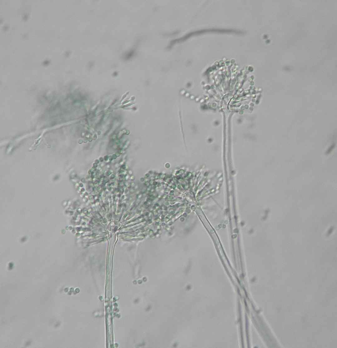 ATLAS MICOLOGIA: ASPERGILLUS VERSICOLOR