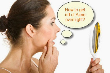 How to Get Rid of Acne Overnight Naturally