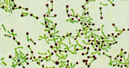 Food Borne Disease: Characteristics of the Corynebacterium diphtheriae
